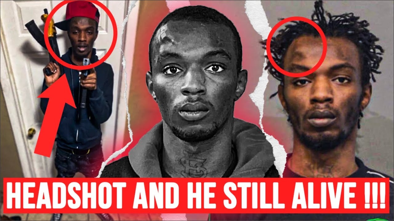 HOW WOOSKI GOT SHOT IN THE HEAD AND SURVIVED | Certified BOOTLEG