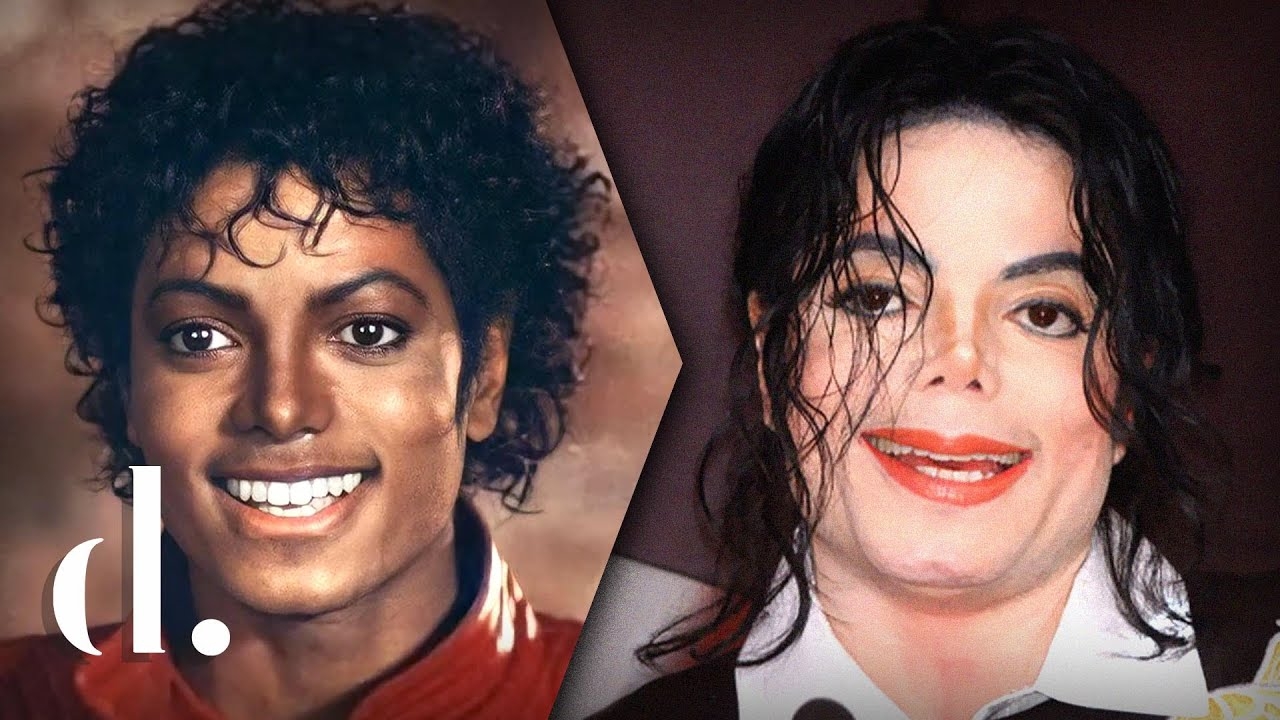 Whatever Happened to Michael Jackson's Famous Smile? | the detail ...